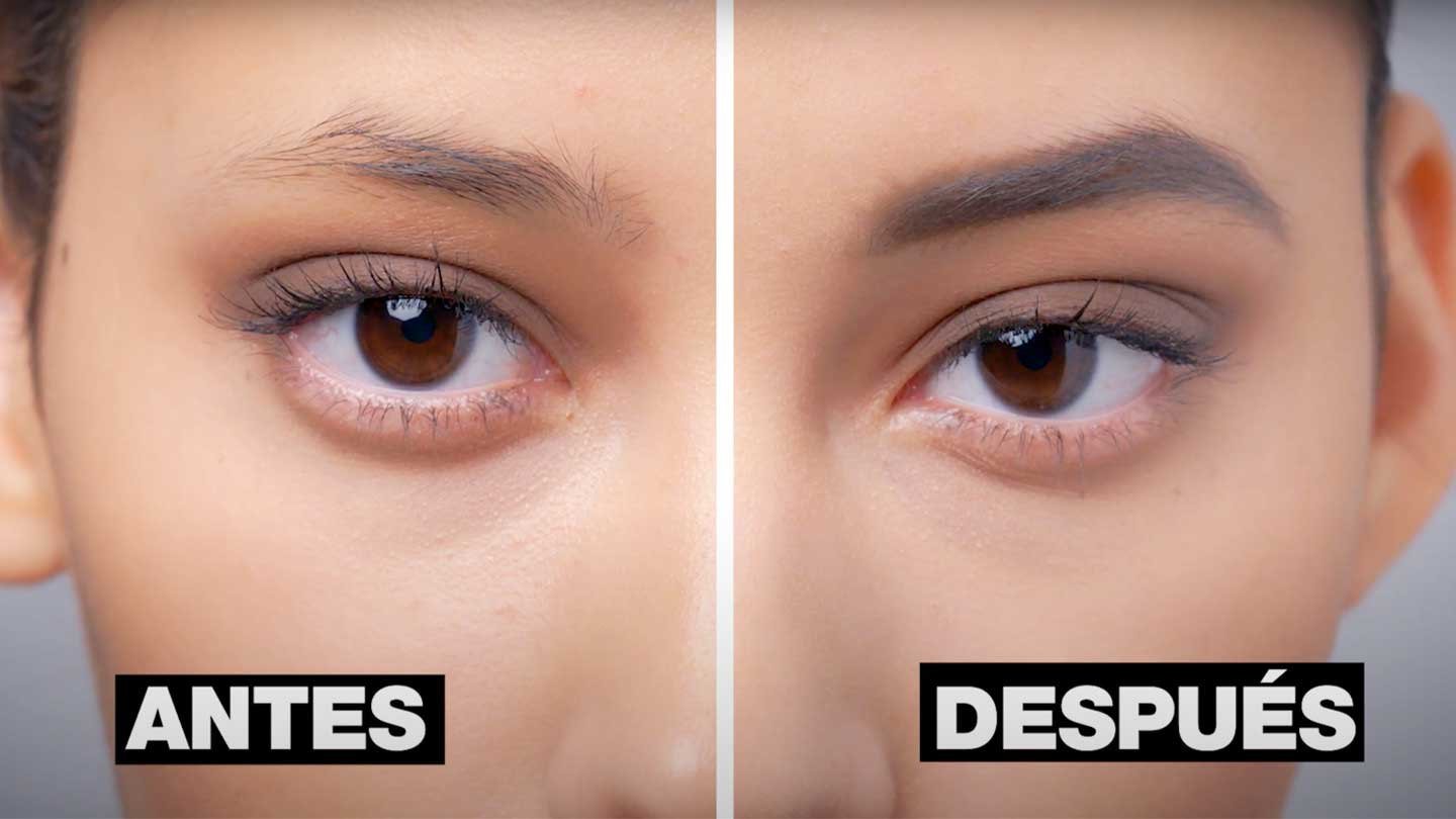 Personas Sin Cejas Antes Y Despues Botox En Las Cejas: Antes Y
